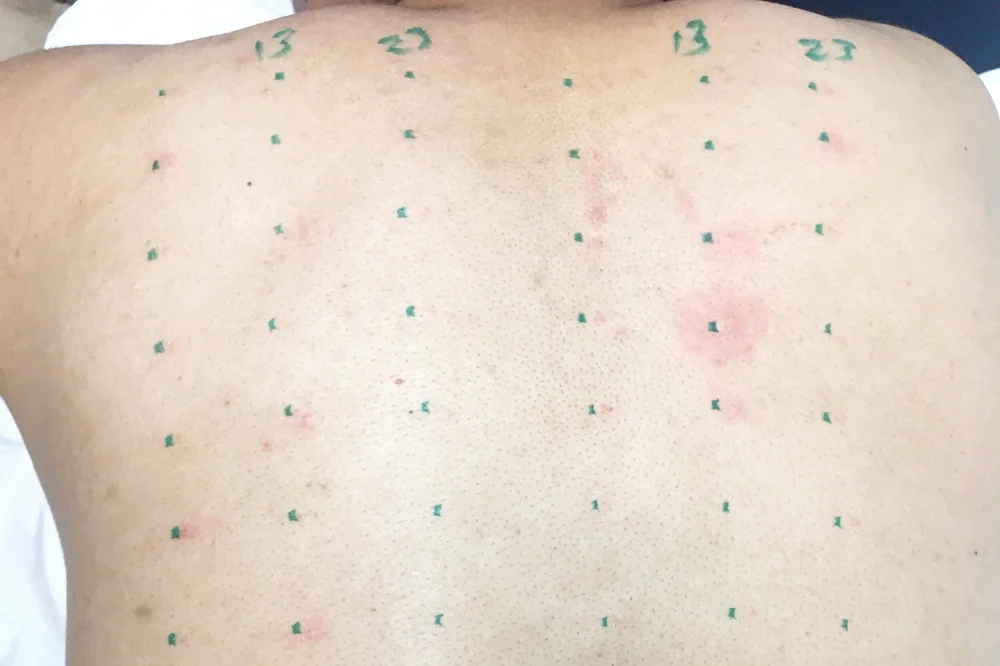 Universal Allergy Solutions