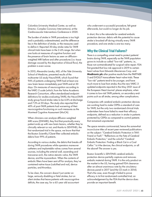 Latest News & Updates on Stroke Prevention Technology | Transverse ...