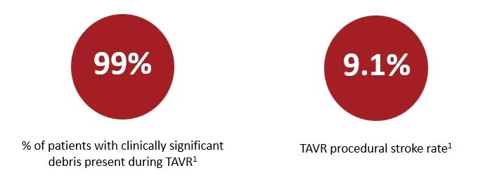 The Clinical Need for Stroke Prevention During Cardiovascular ...
