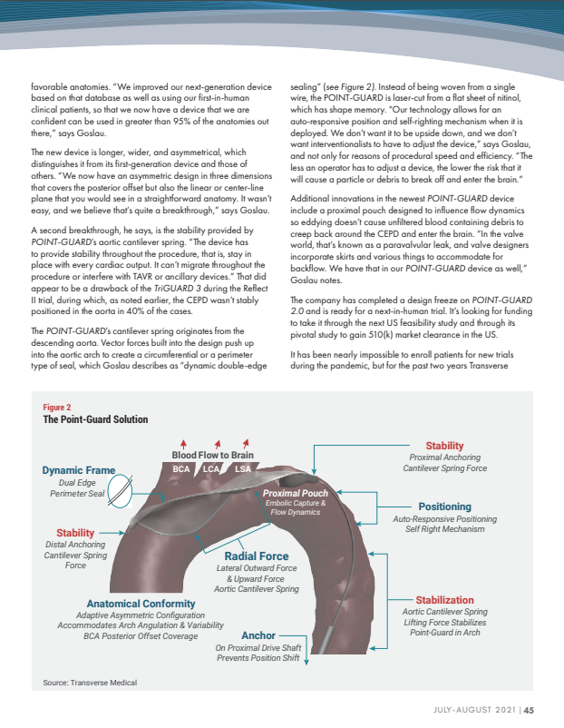 Latest News & Updates on Stroke Prevention Technology | Transverse ...