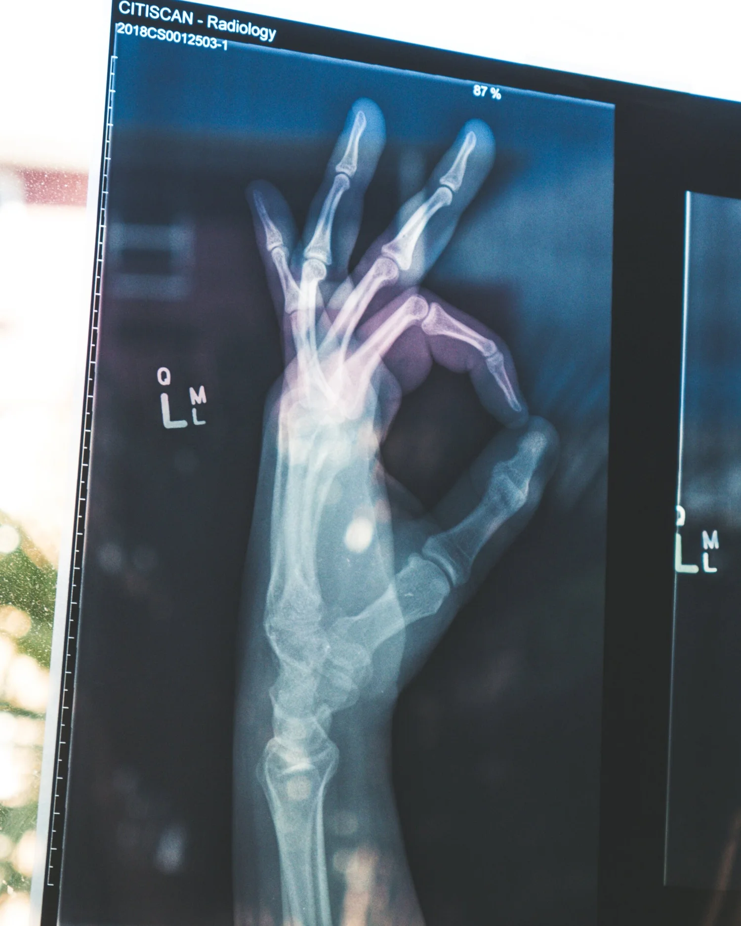 Contact Us — Synergy Mobile Radiology - Mobile X-Ray and Ultrasound Orders