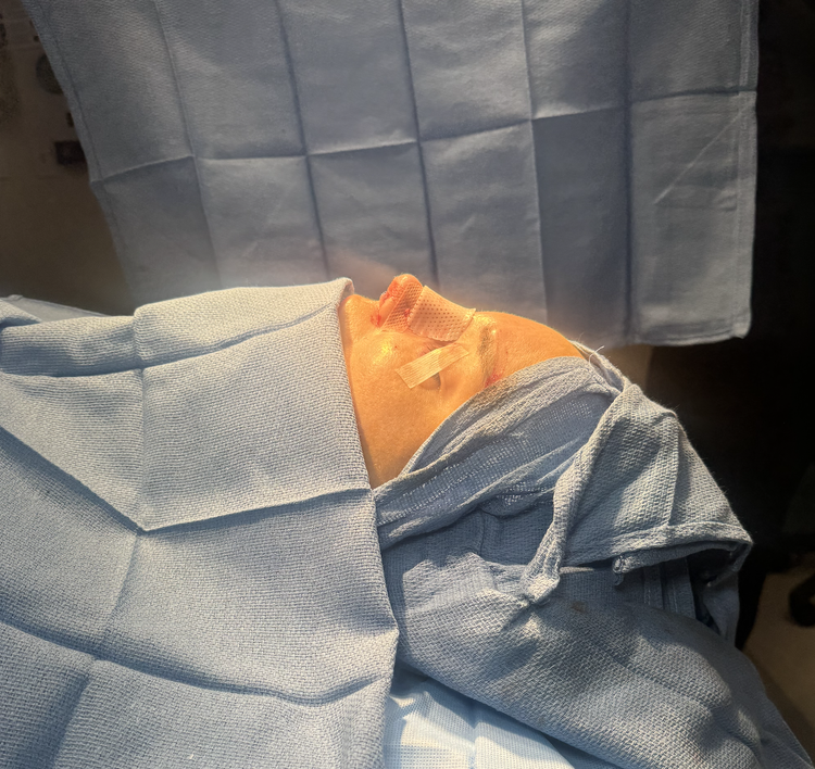 MOUNTAIN VIEW SURGICAL CENTERMountain View Surgical Center — General ...