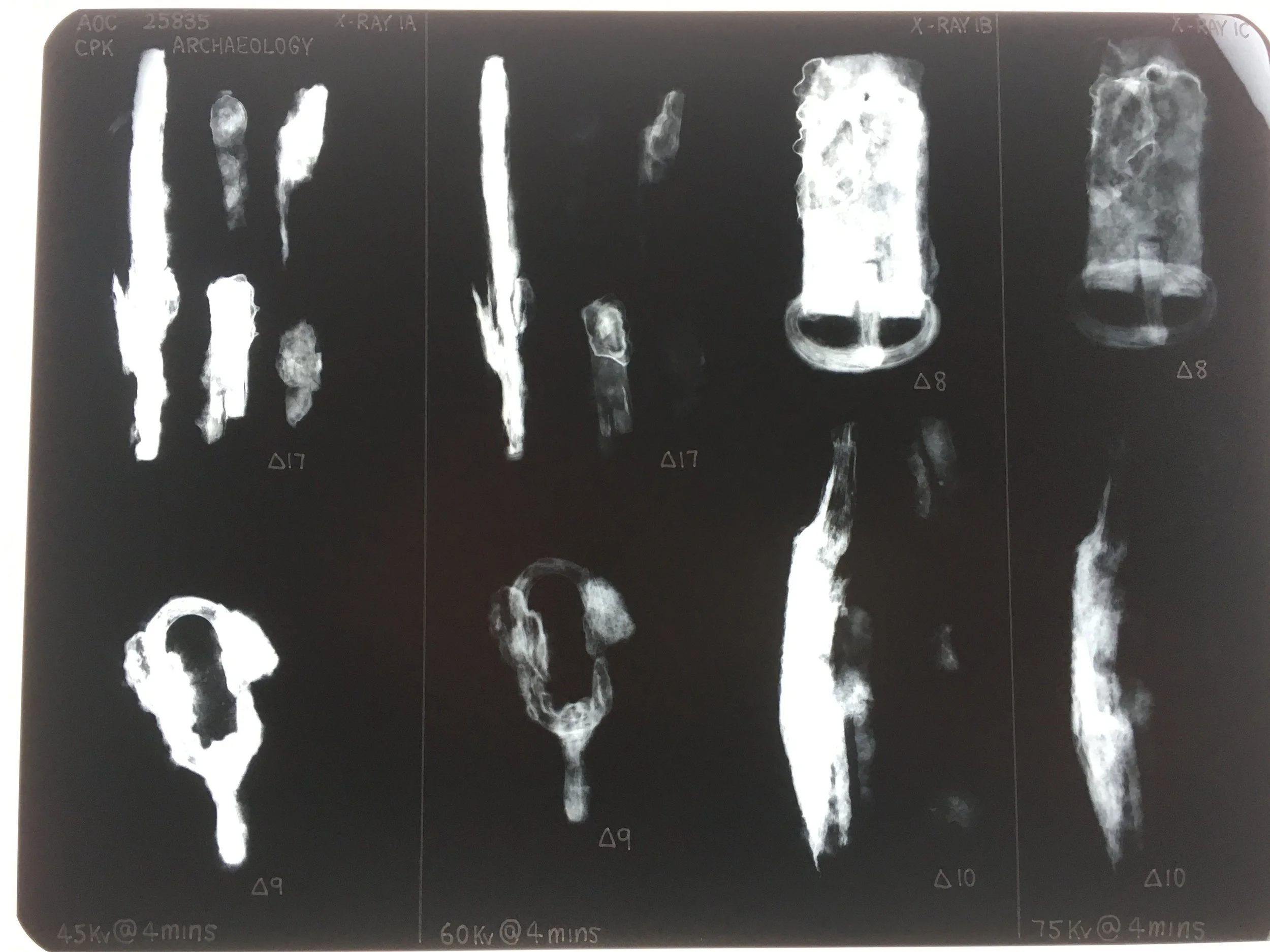 X-Ray Vision — AOC Archaeology Group