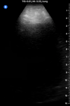 Lung Ultrasound — POCUS UK