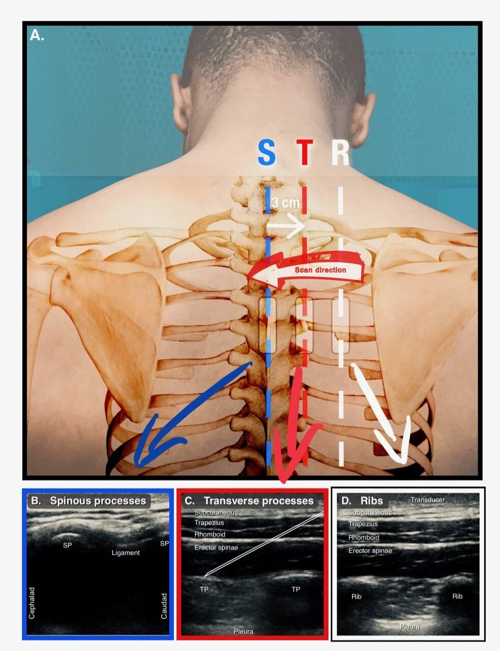 Nerve/Plane Blocks — POCUS UK
