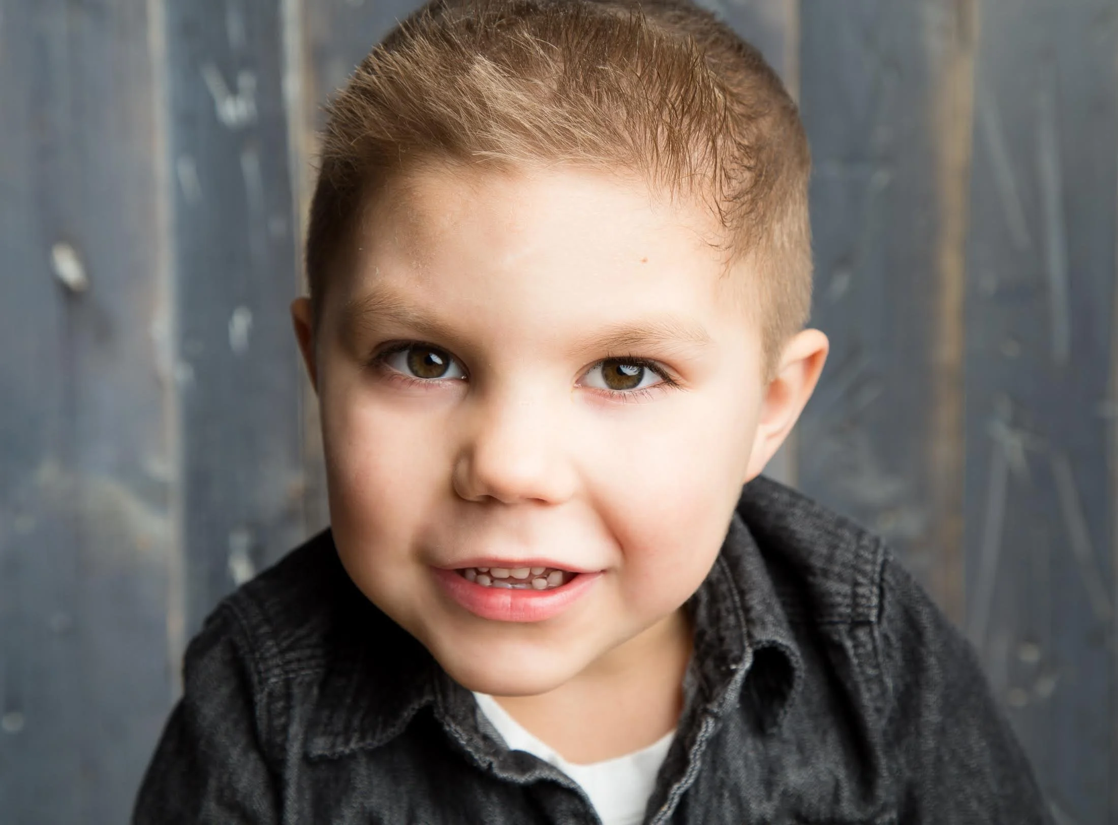 What is BBS? — Bardet Biedl Syndrome Foundation