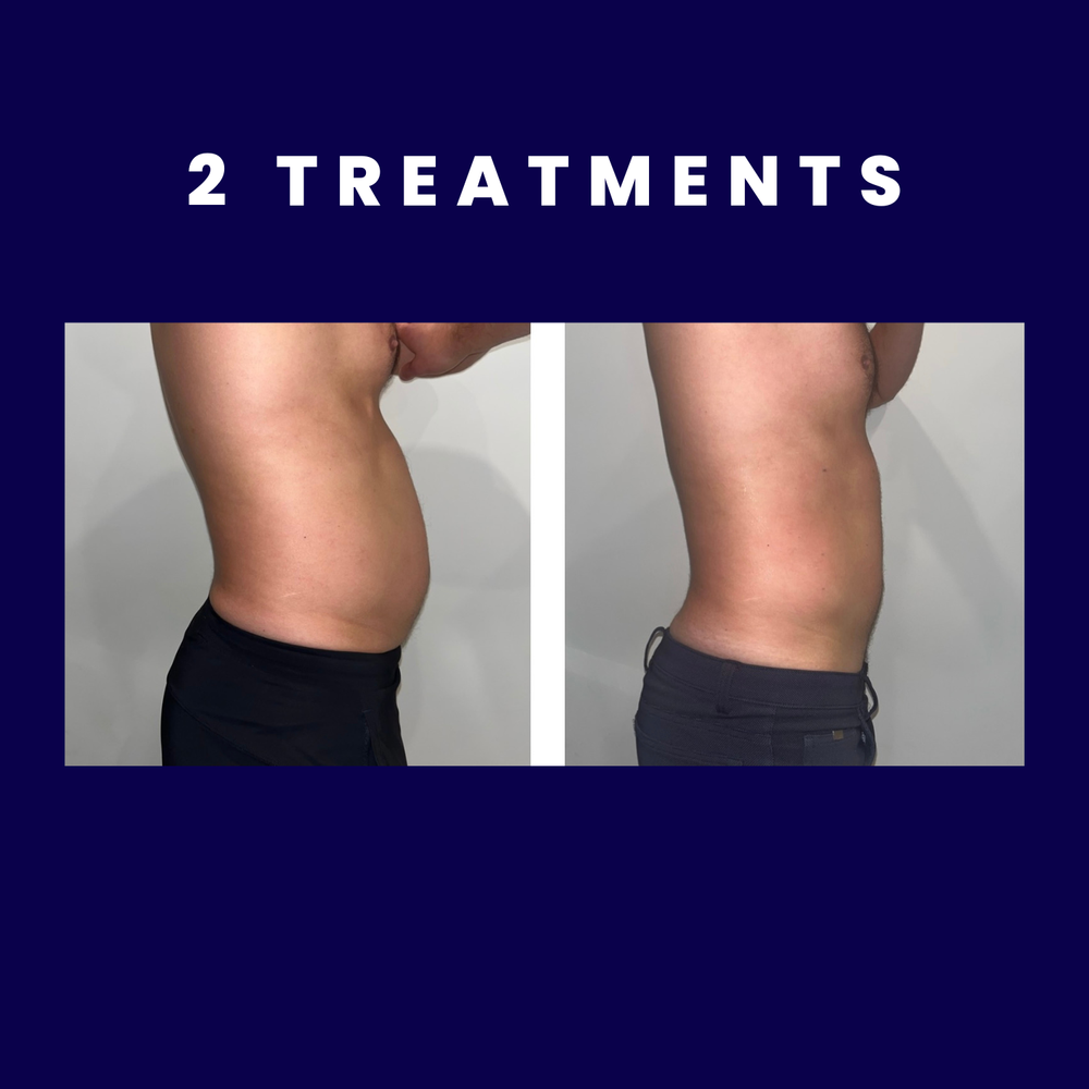 Melt Body Health