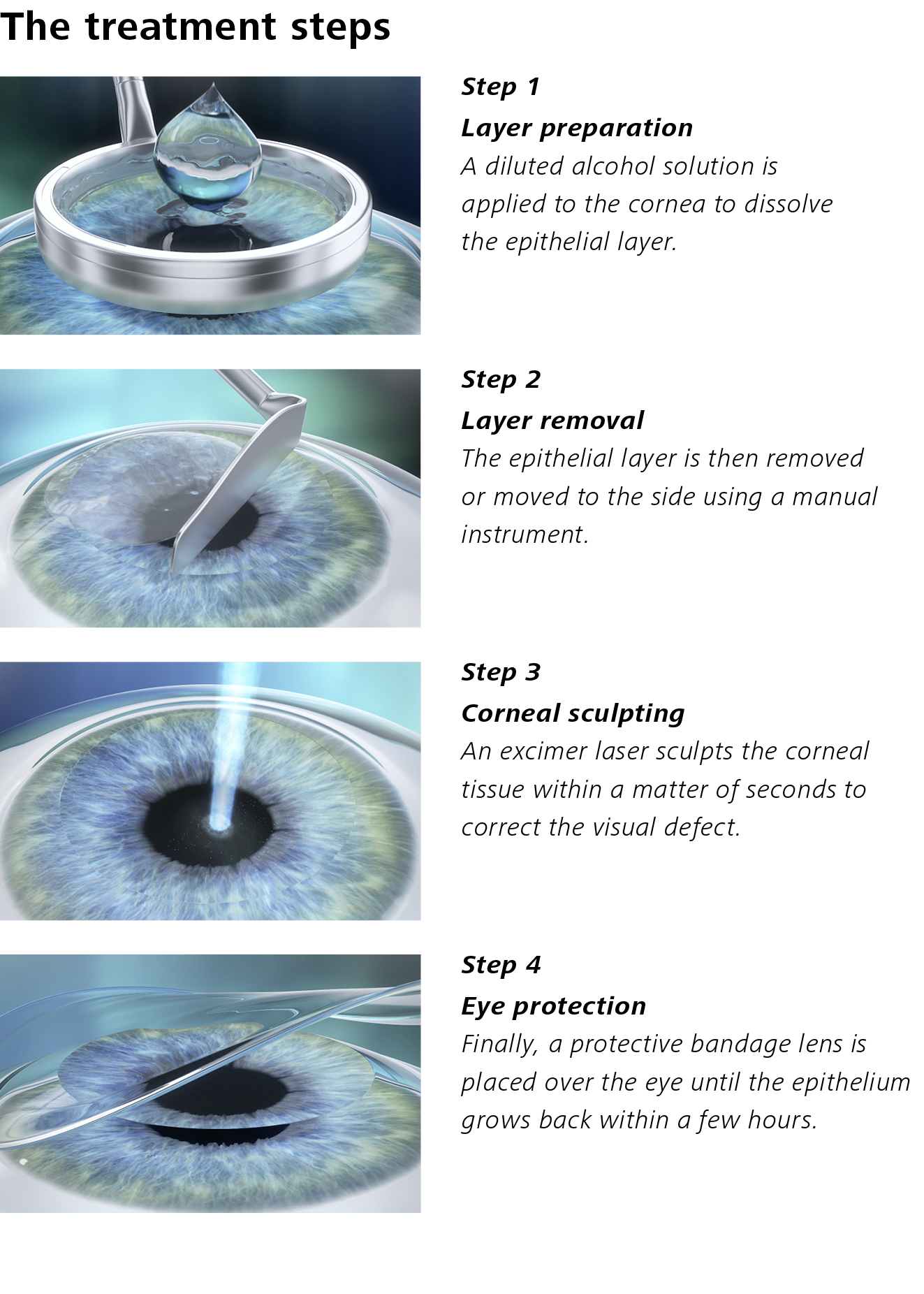 BGN Eye Clinic (BGN밝은눈안과 잠실)