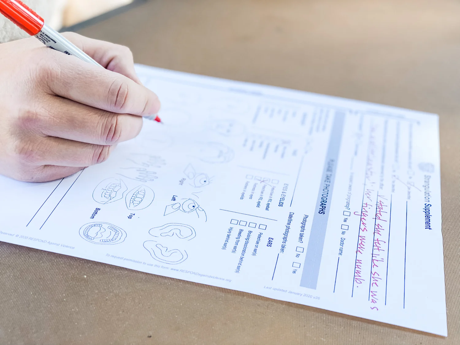 strangulation supplement — Respond Against Violence