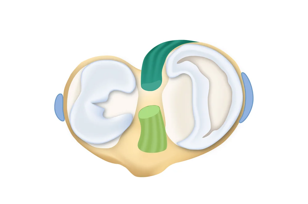 Meniscus Injury Treatment Melbourne | Meniscal Conditions