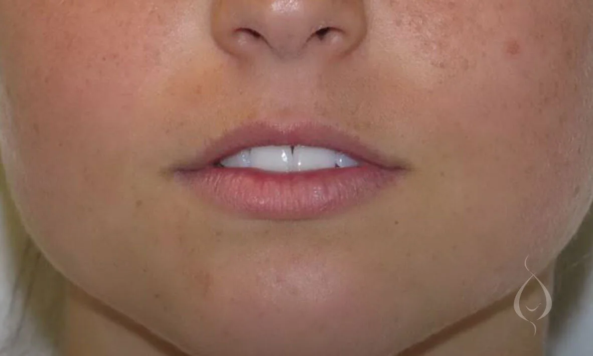 Transform Your Smile with Aesthetic Periondontal Surgery — Smile ...