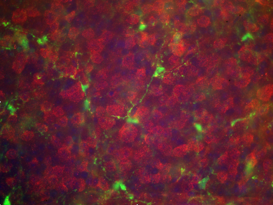 Cui Lab | Drive Innovation - Explore Eye Research
