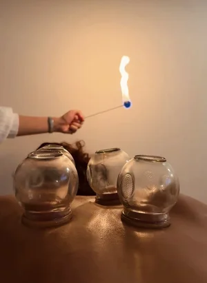Fire Cupping Therapy in Los Angeles | IN8LOVE WELLNESS