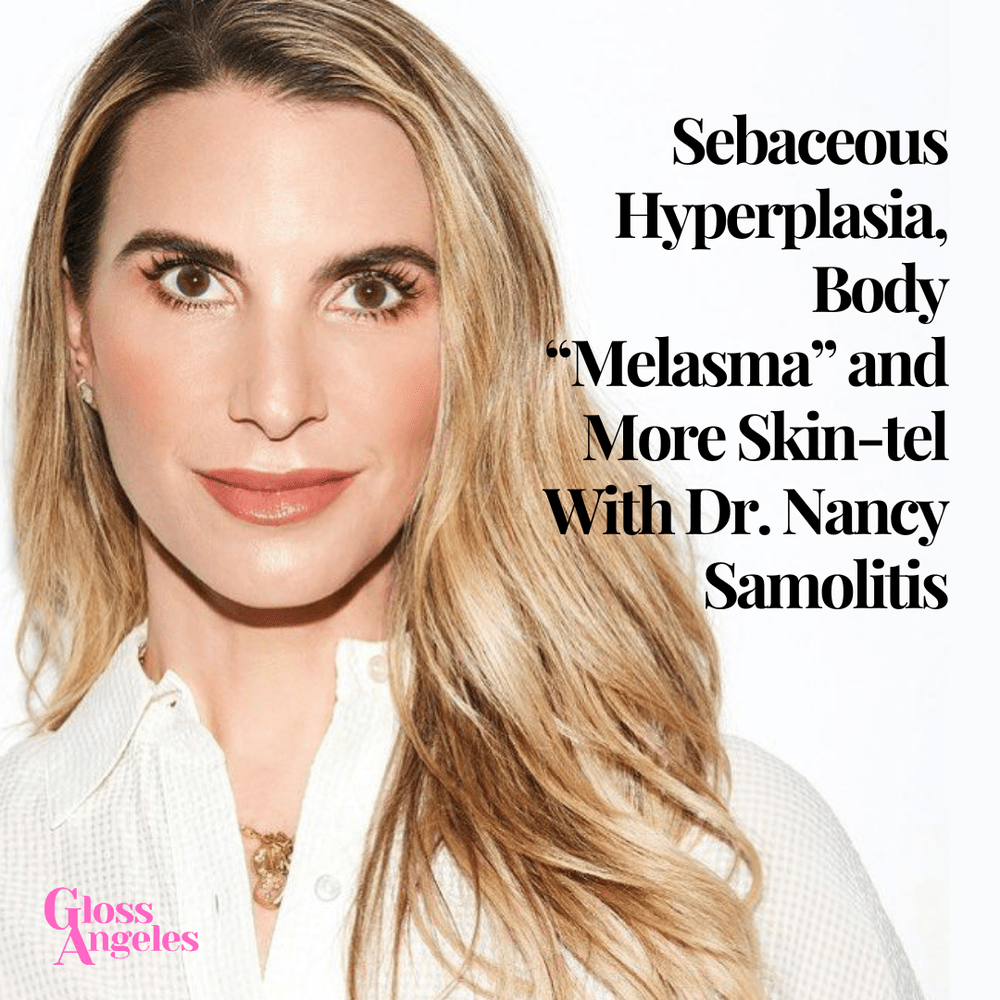Sebaceous Hyperplasia, Body "Melasma" and More Skin-tel With Dr. Nancy ...
