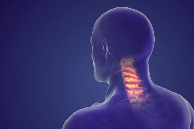 Cervical Alignment: A Key Factor in Managing Chronic Headaches — Demuth ...