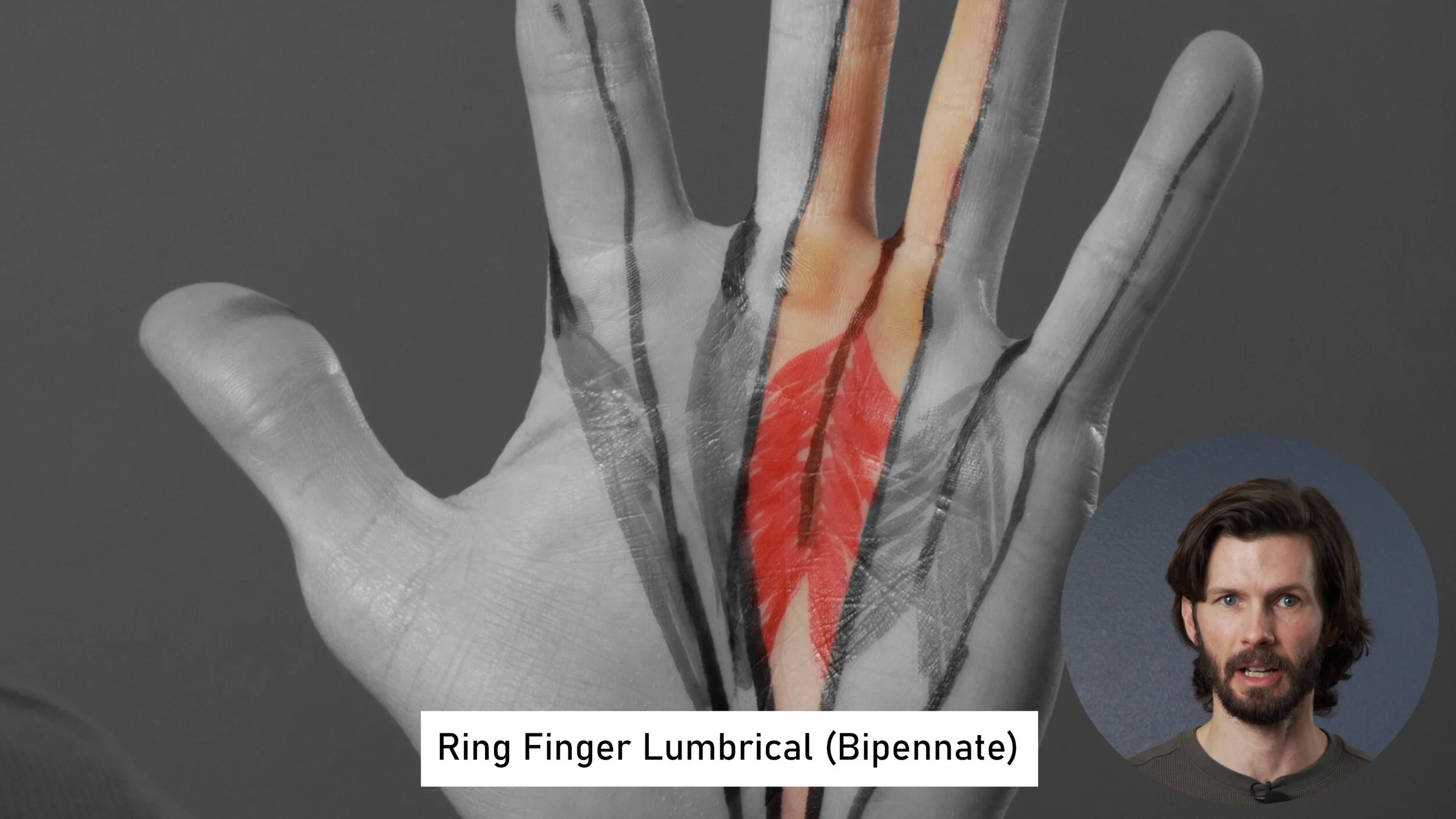 What Climbers Should Know About Lumbricals (Pain After Climbing Pockets ...