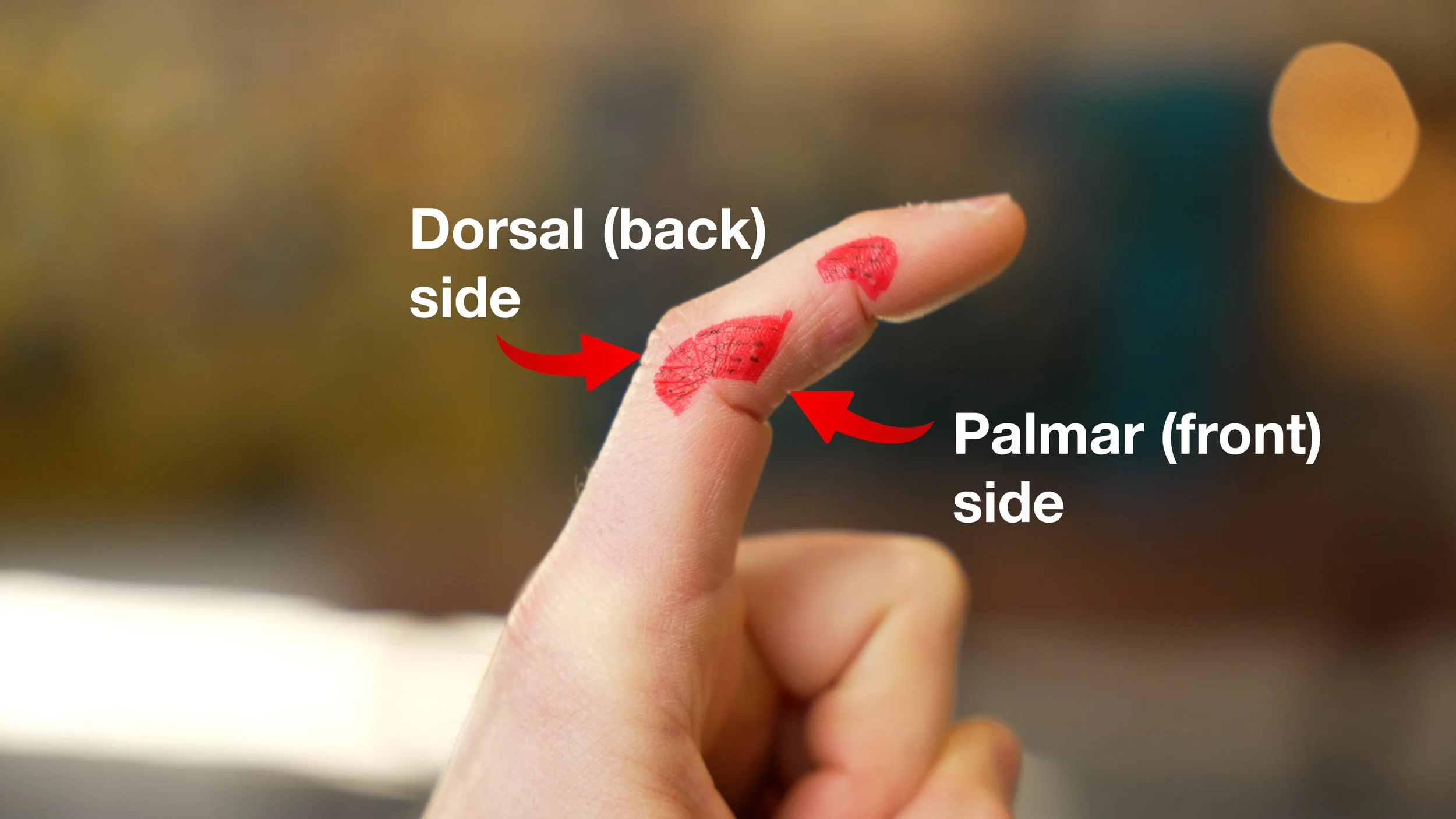 Collateral Ligament Injury from Rock Climbing (Causes & Fix) — Hooper's ...