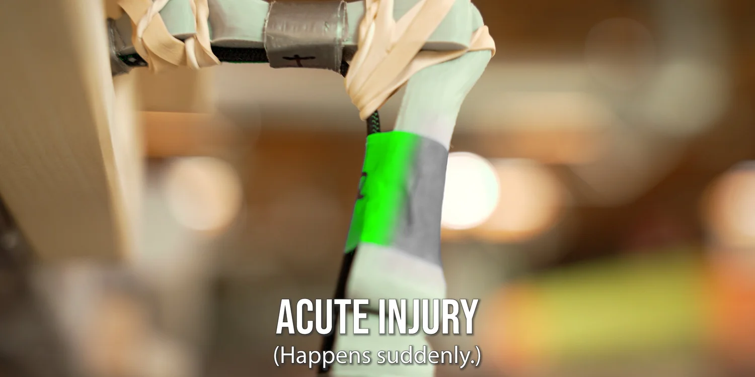 Ultimate A2 Pulley Injury Recovery Guide (PT's Full Protocol) — Hooper ...