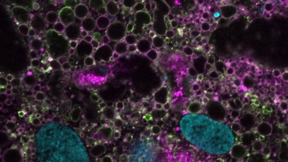 Projects — Sanders Lab (UTSW)