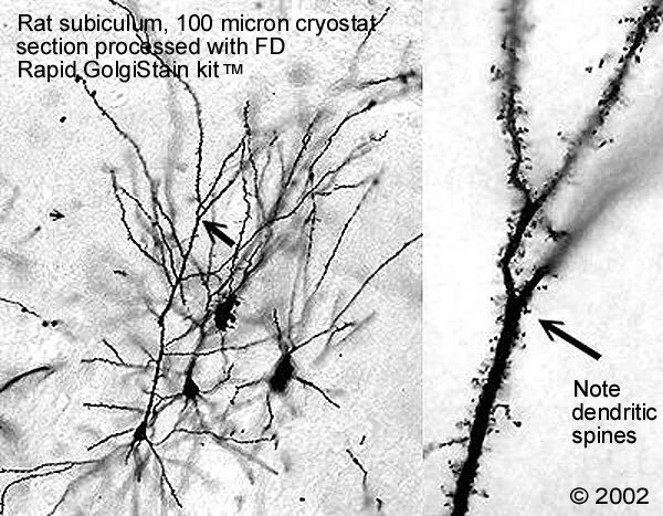 Neurodigitech, a neuro-based CRO