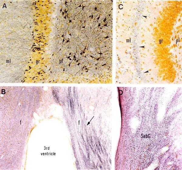 Laboratory histology — Neurodigitech, a neuro-based CRO