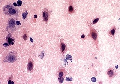 Routine staining — Neurodigitech, a neuro-based CRO