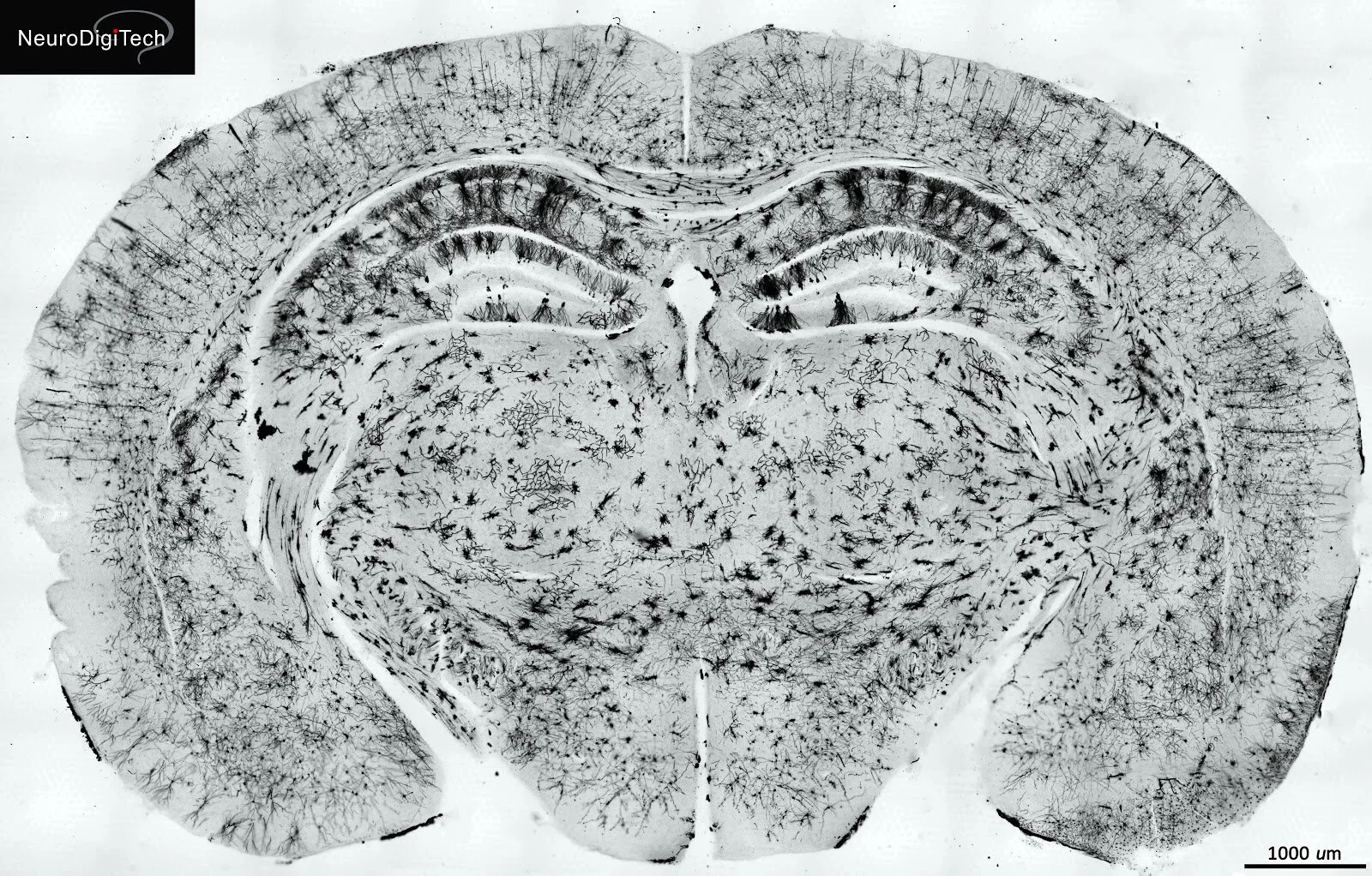 Shematic Of Mouse Brain Coronal Section