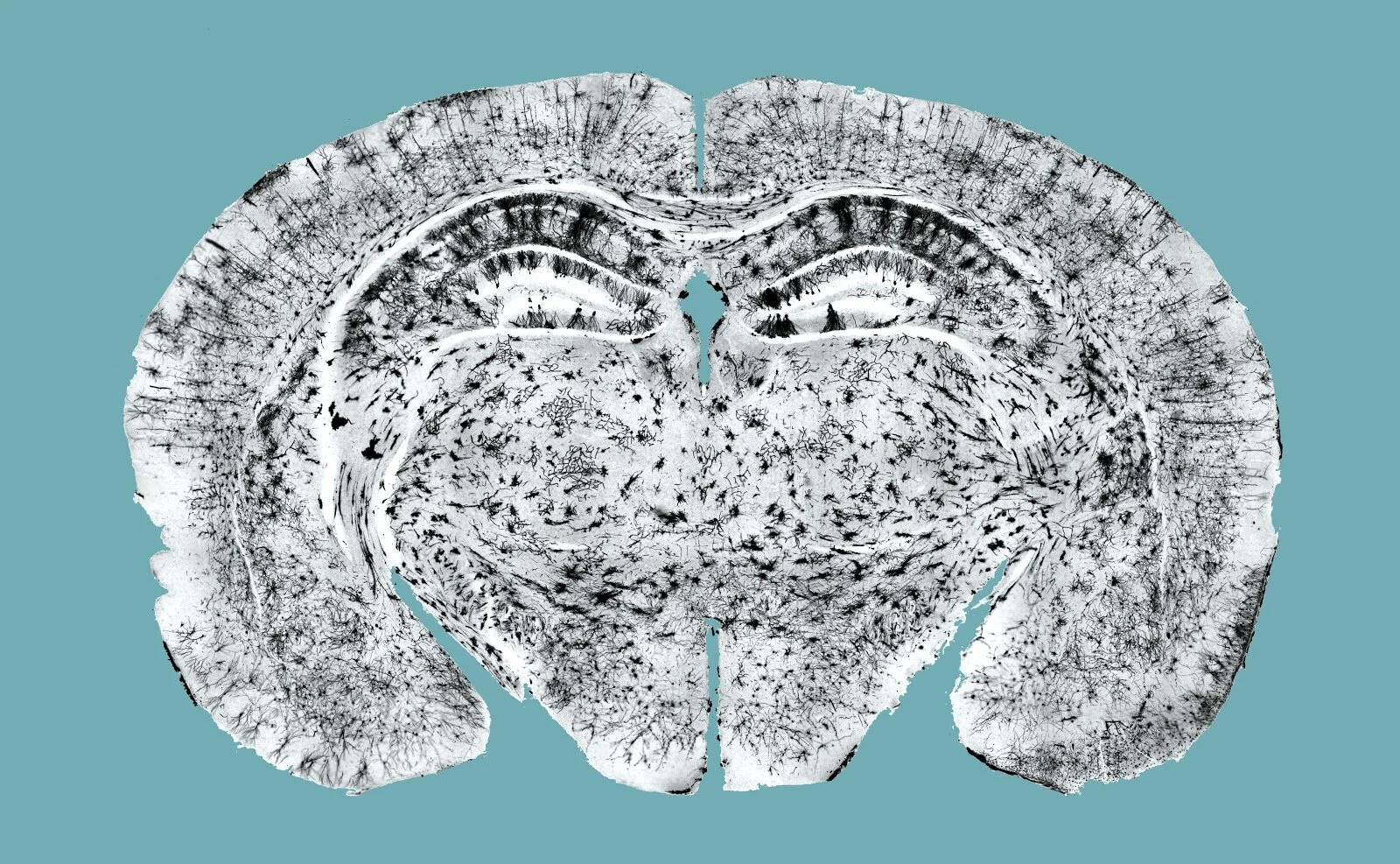 Neural Gallery — Neurodigitech, a neuro-based CRO