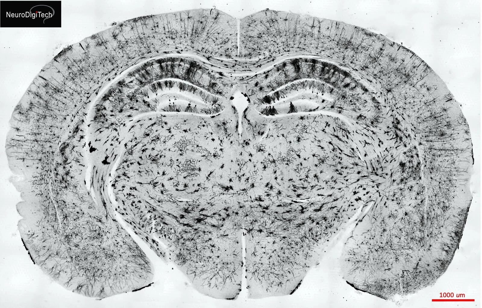 FD Rapid GolgiStain Kit — Neurodigitech, a neuro-based CRO