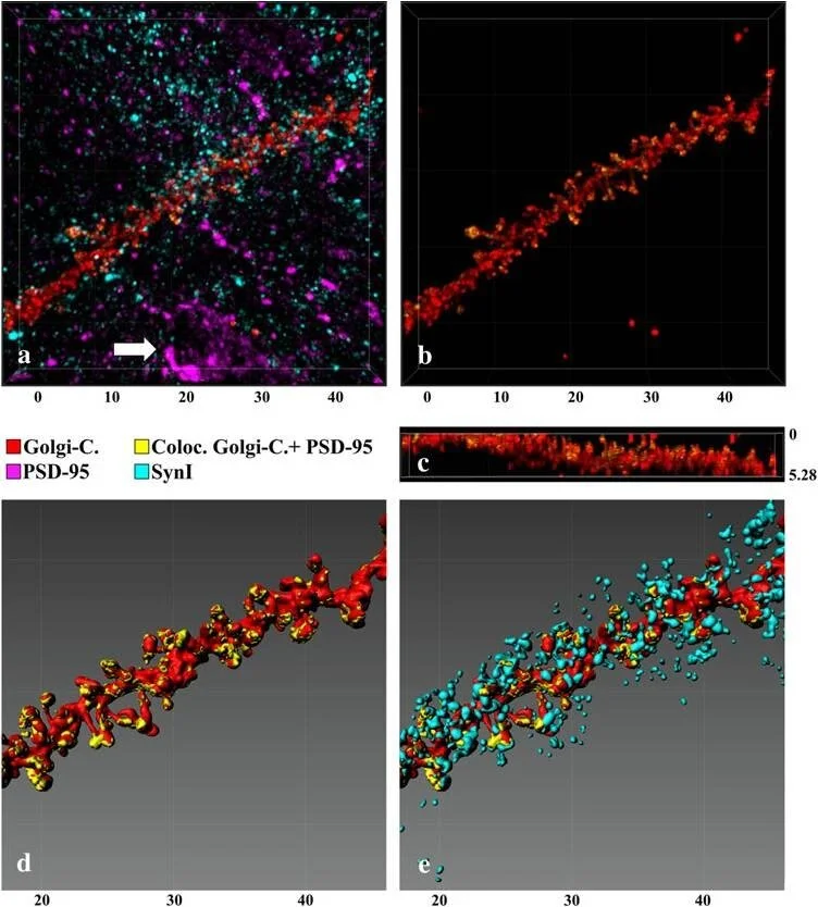 GolgiChrome staining Service — Neurodigitech, a neuro-based CRO