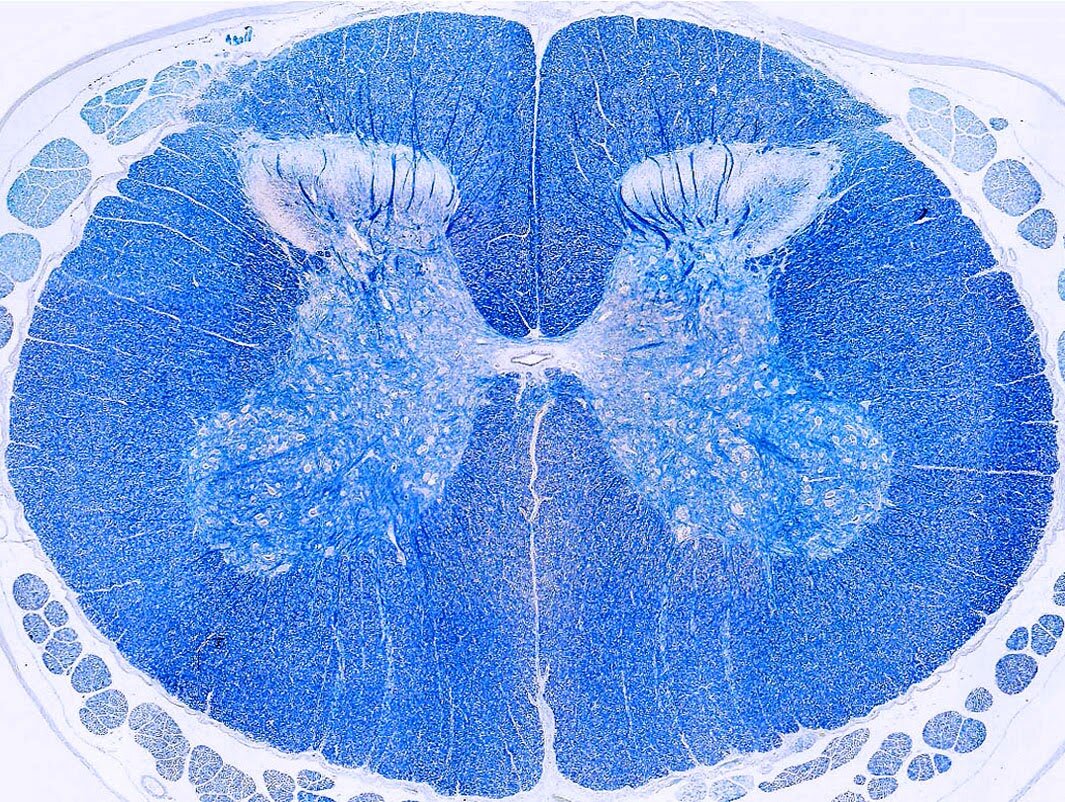 FD Luxol Fast Blue Solution — Neurodigitech, a neuro-based CRO
