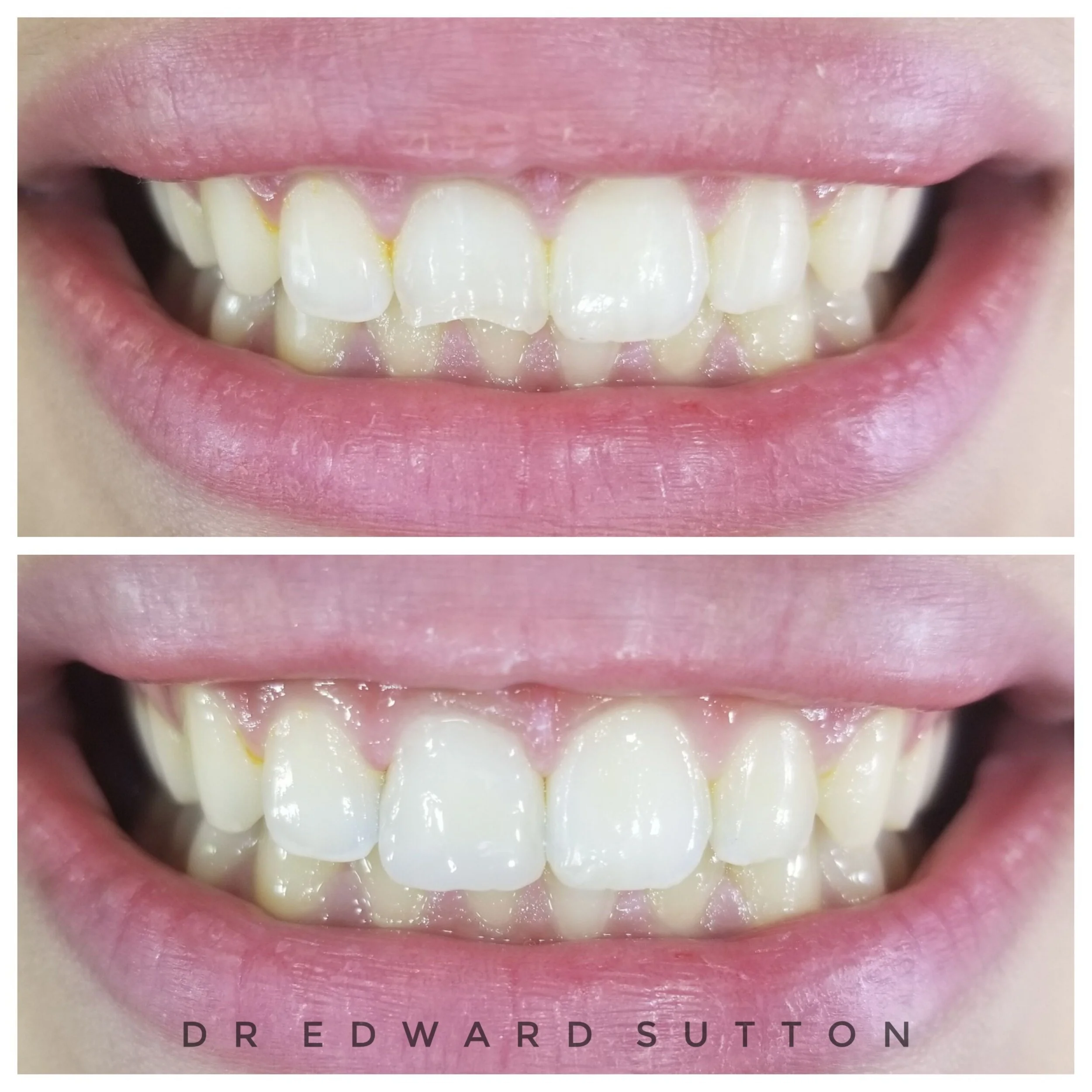 Smile Gallery — Sutton Dentaire