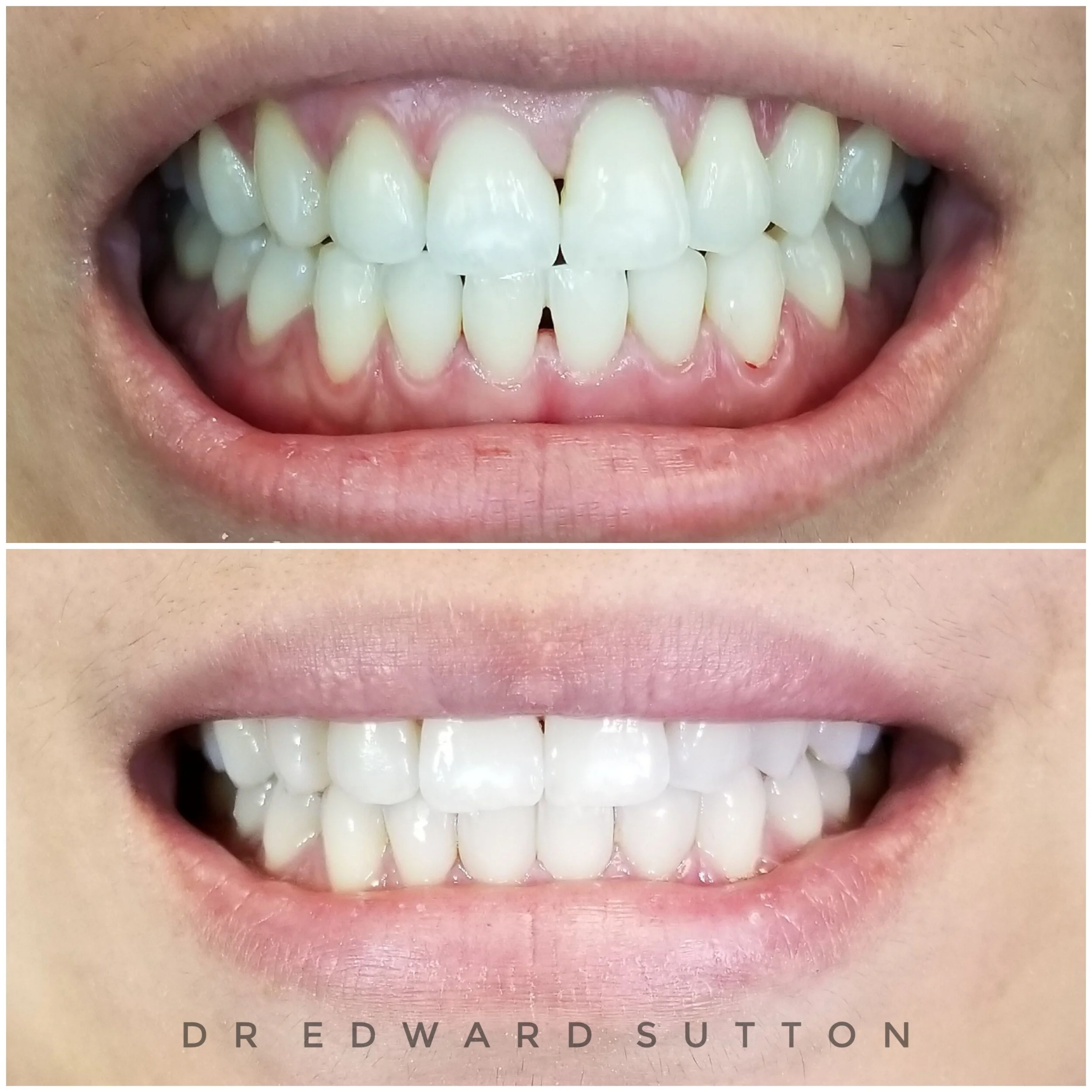 Smile Gallery — Sutton Dentaire