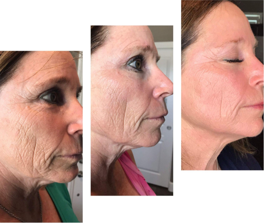 Microcurrent — Lindy's Skin Studio