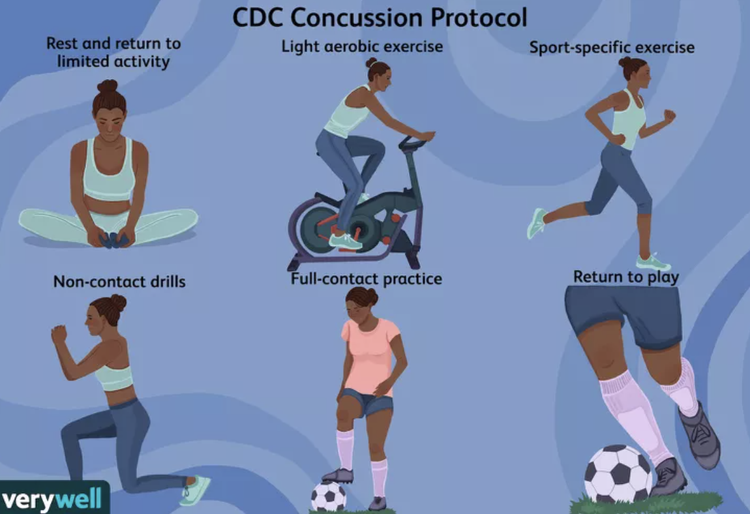 Managing Football-Related Concussions with Physical Therapy-Mangiarelli ...