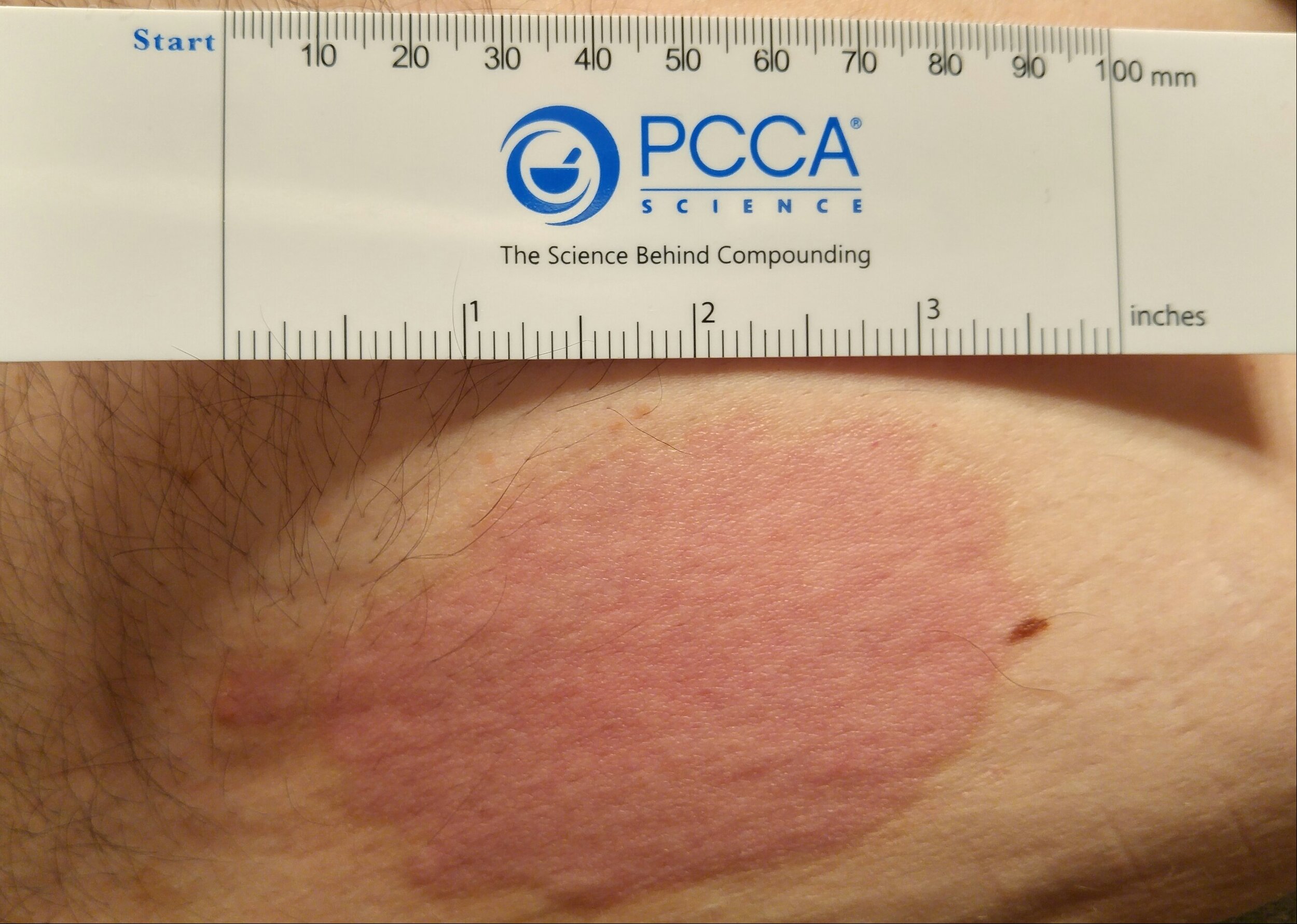 Want to beat dry skin? Meet Xematop™. — Alpine Apothecary