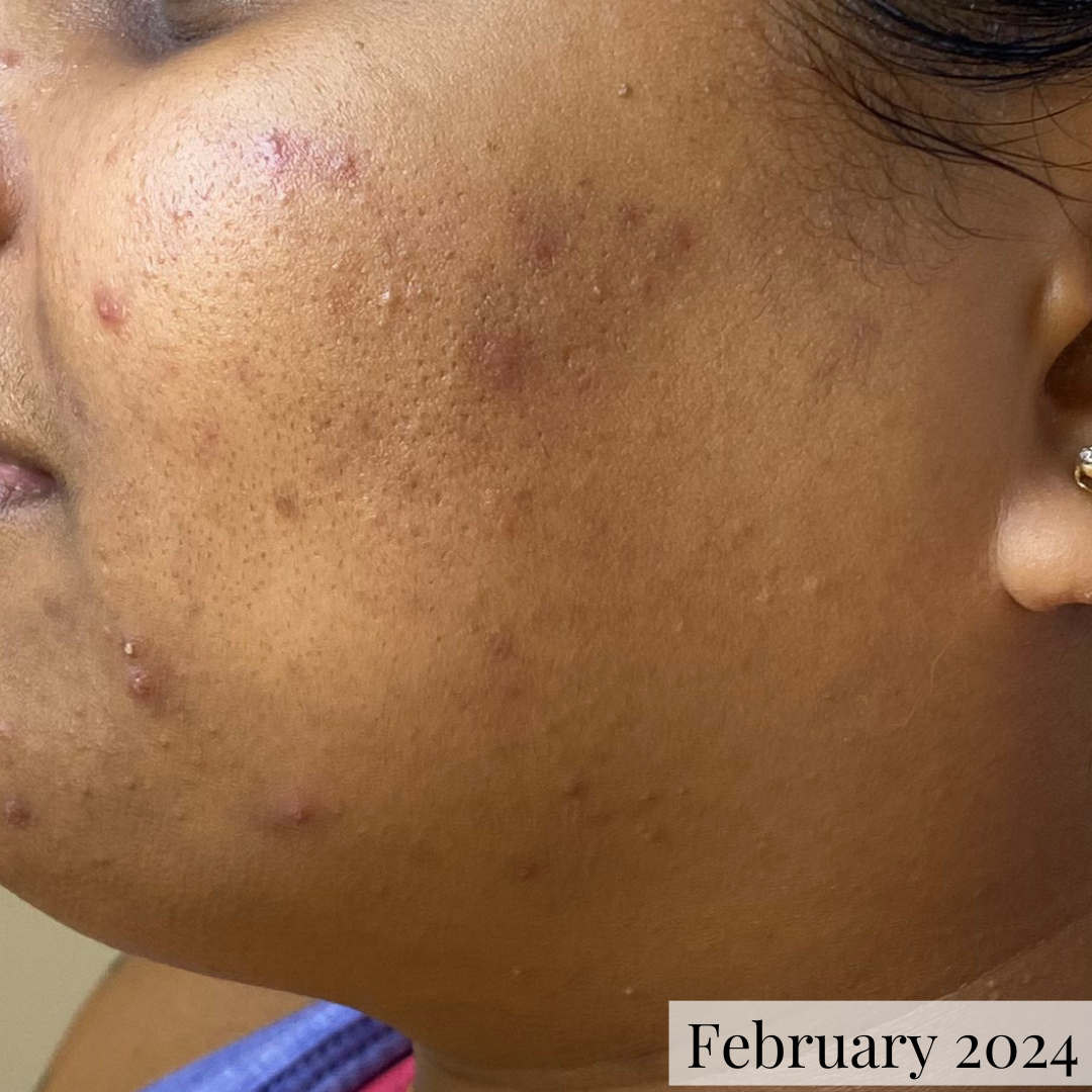 Skin Care Success Stories — self.skin