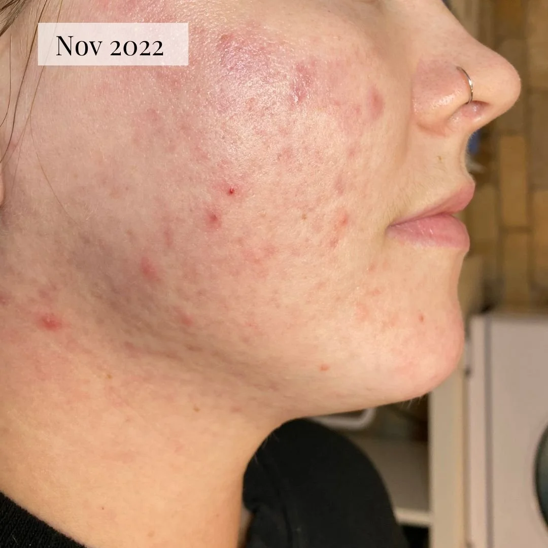 Skin Care Success Stories — self.skin