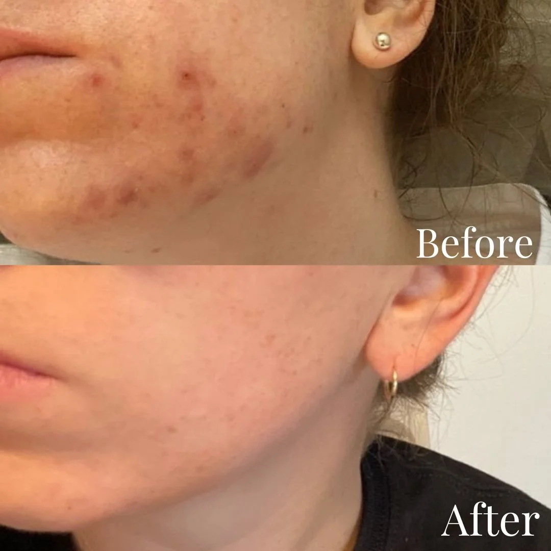 Skin Care Success Stories — self.skin