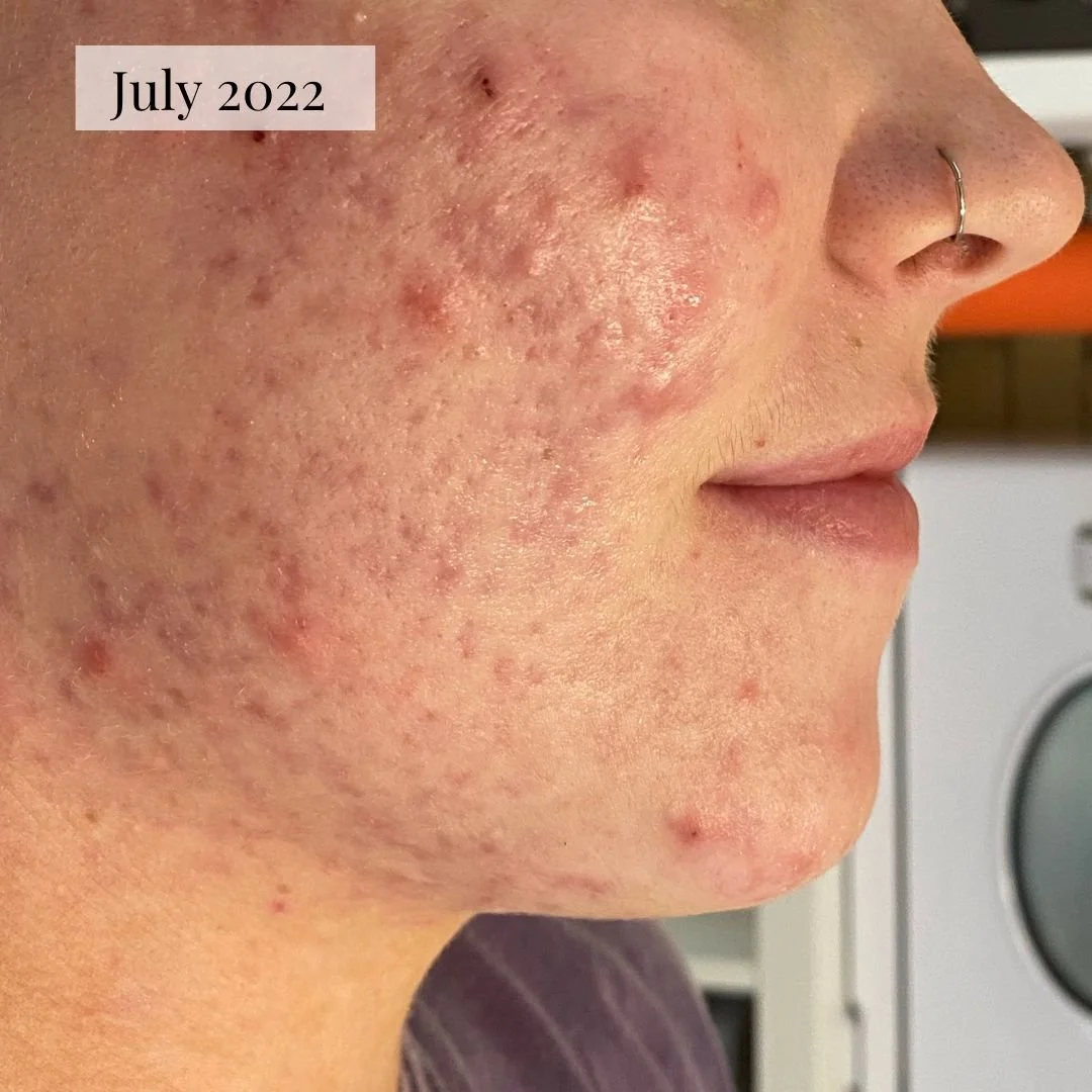 Skin Care Success Stories — self.skin