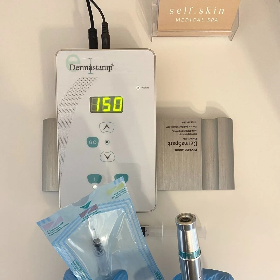 What is Micro-Needling and Do I Need It? — self.skin