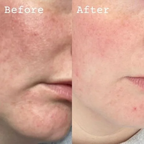 Skin Care Success Stories — self.skin