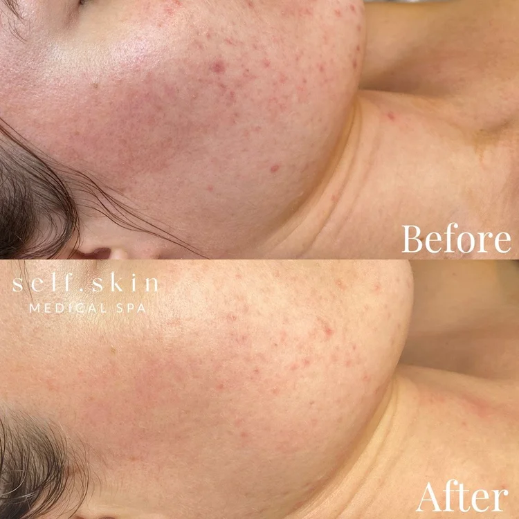 Skin Care Success Stories — self.skin