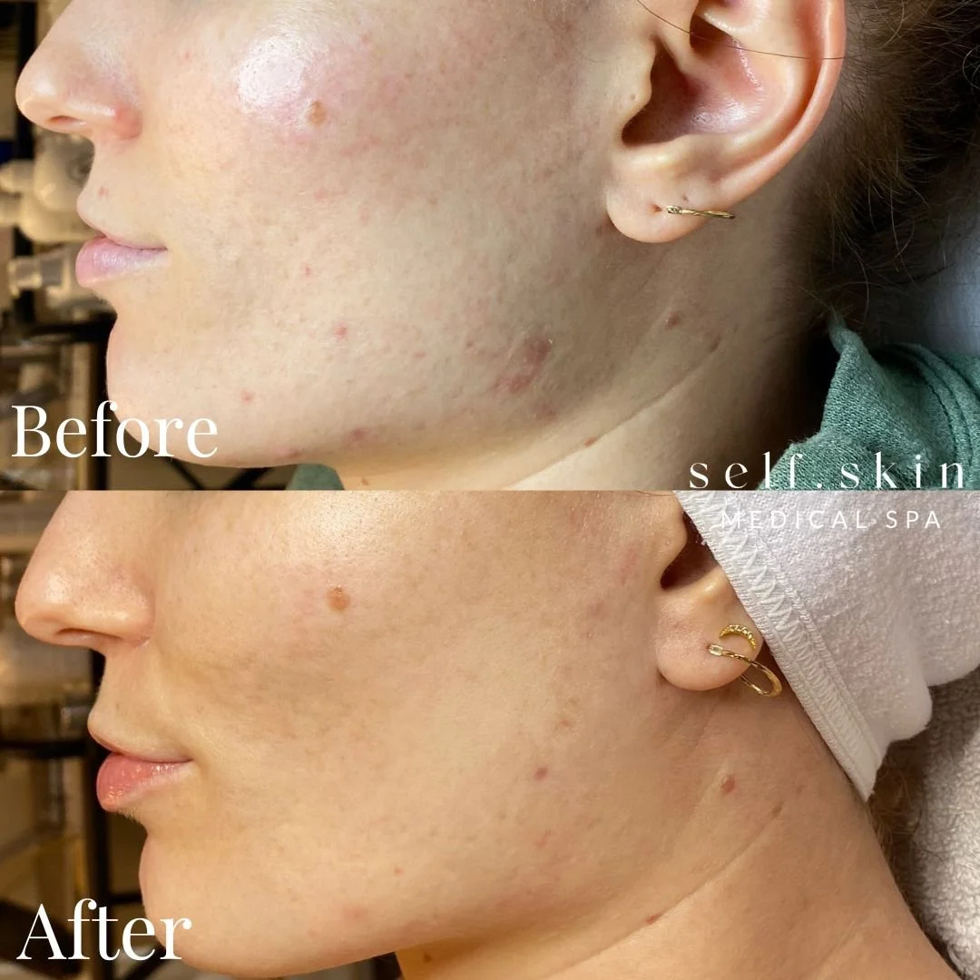 Skin Care Success Stories — self.skin
