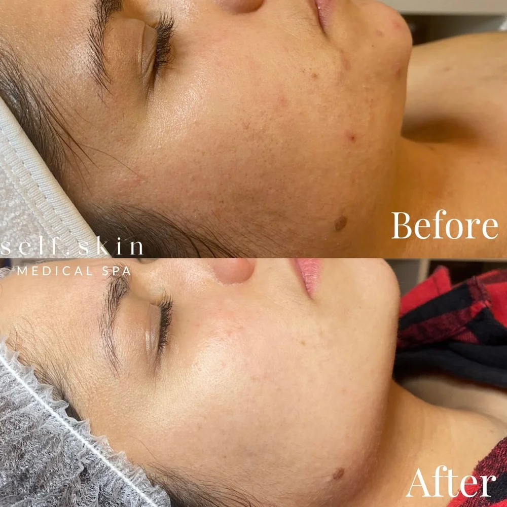 Skin Care Success Stories — self.skin
