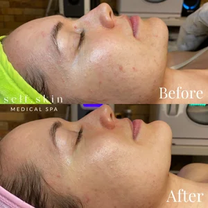 Skin Care Success Stories — self.skin
