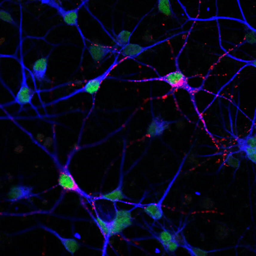 Brain Neuron Activity