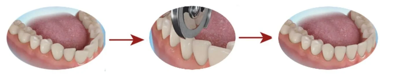 IPR — Newport Medical Dental