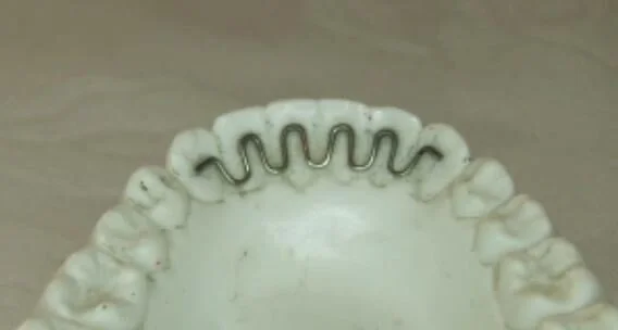 retainers — Newport Medical Dental