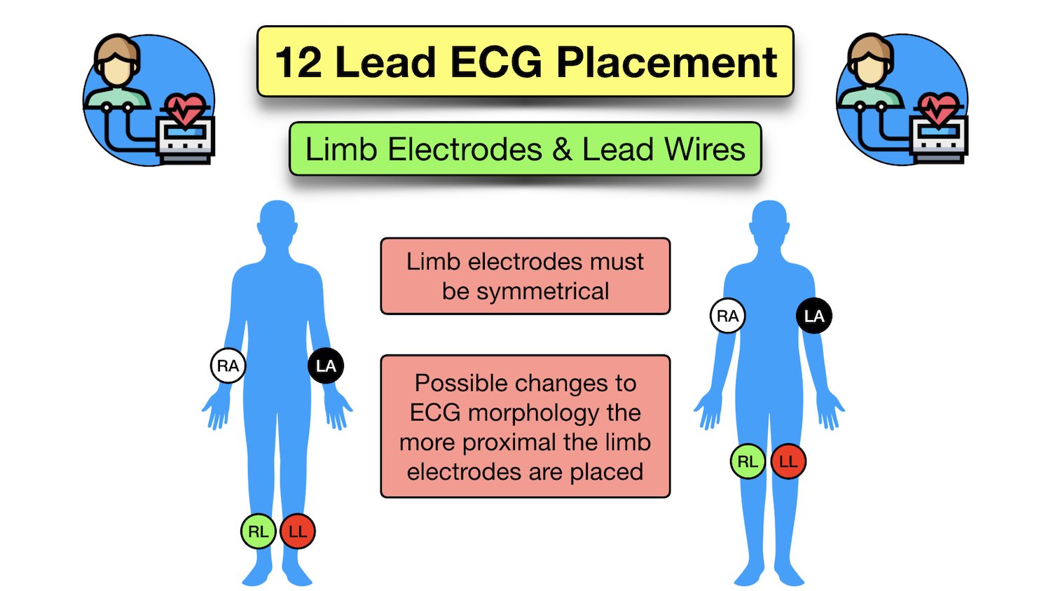 12 Lead Ecg Placement Diagram And Mnemonic For Limb And Precordial Electrode Location — Ezmed